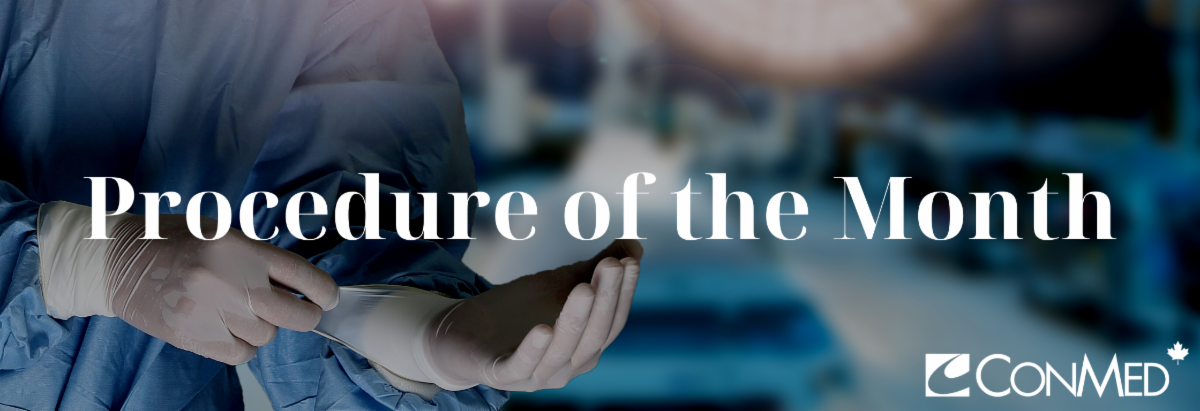 Procedure of the Month - SmartNail Fixation