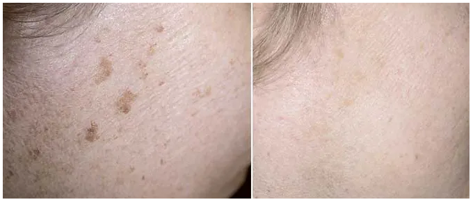 AZURE April Specials