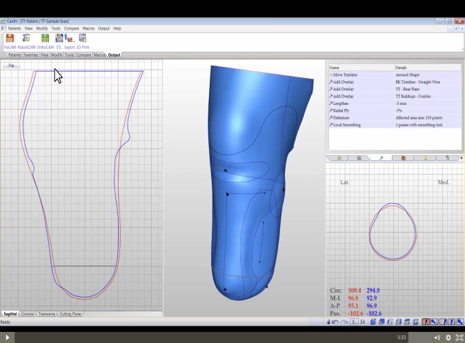 Press Release - Vorum and Create O&P Team Up