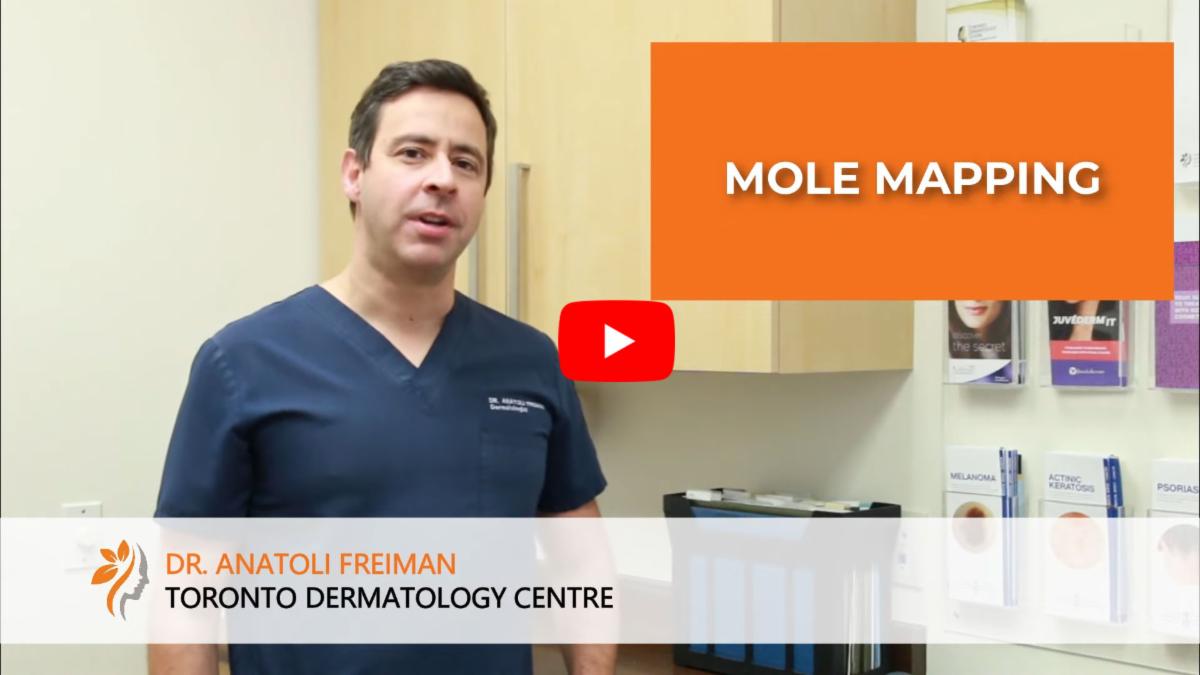 Time to get your moles & spots checked!