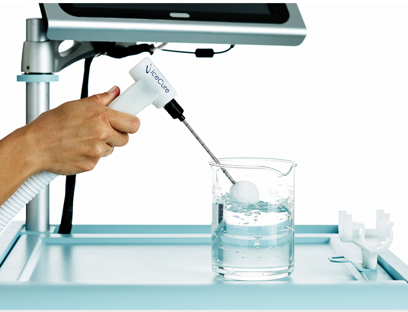 IceCure NEWS – Be the first to know latest cryoablation developments