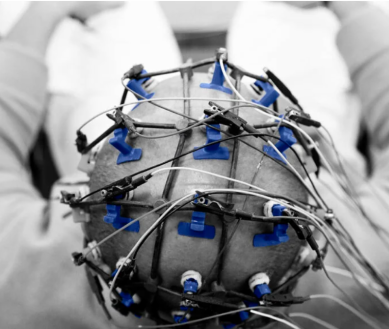 Eeg Test May Improve Pd Diagnosis Lead To New Therapies