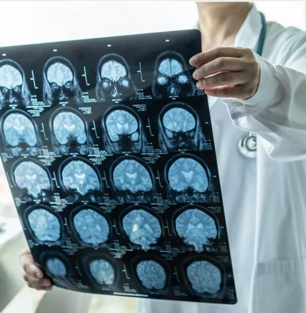 Gene mutation discovery reveals new therapeutic target for PD