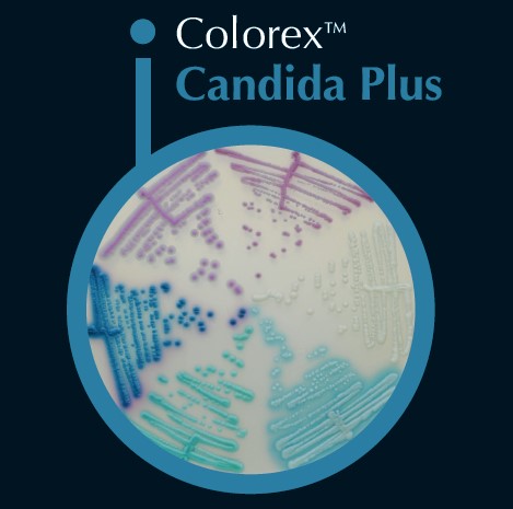 Candida auris - A Growing Concern Among Health Officials