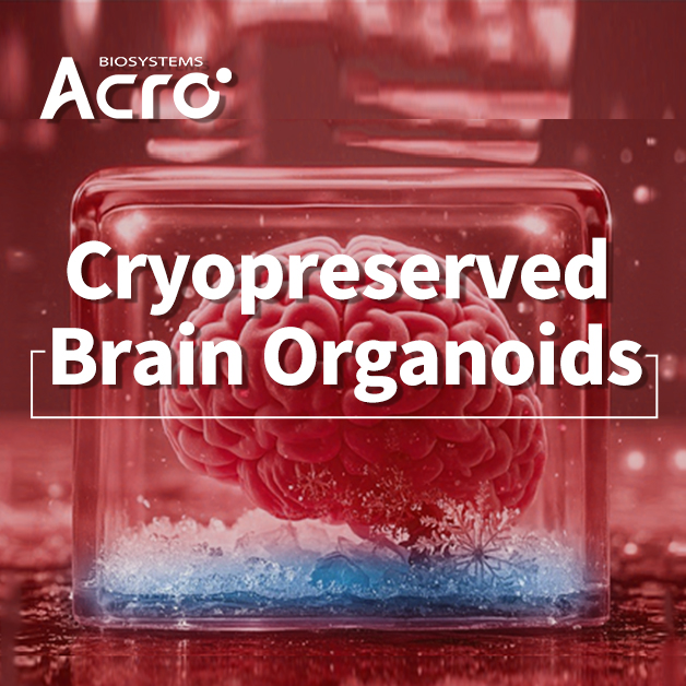 Advancing Neuroscience with iPSC-Derived Brain Organoids