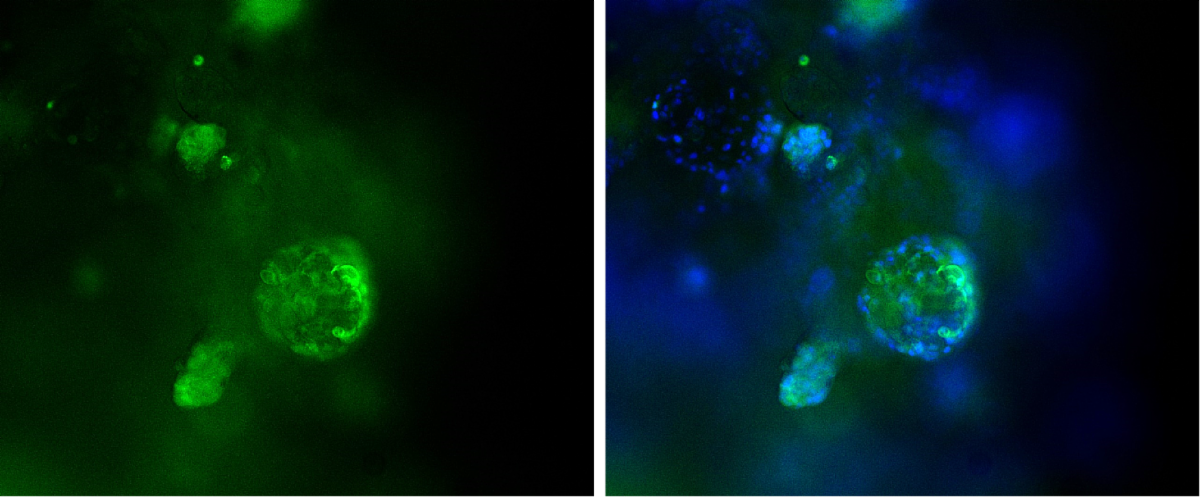 CDF Detection in Hepatotoxicity Research