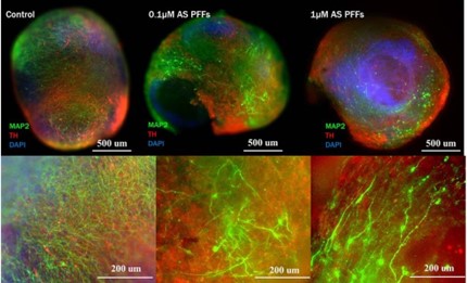 New Product! iPSC-Derived Cerebral Organoid Differentiation Kits