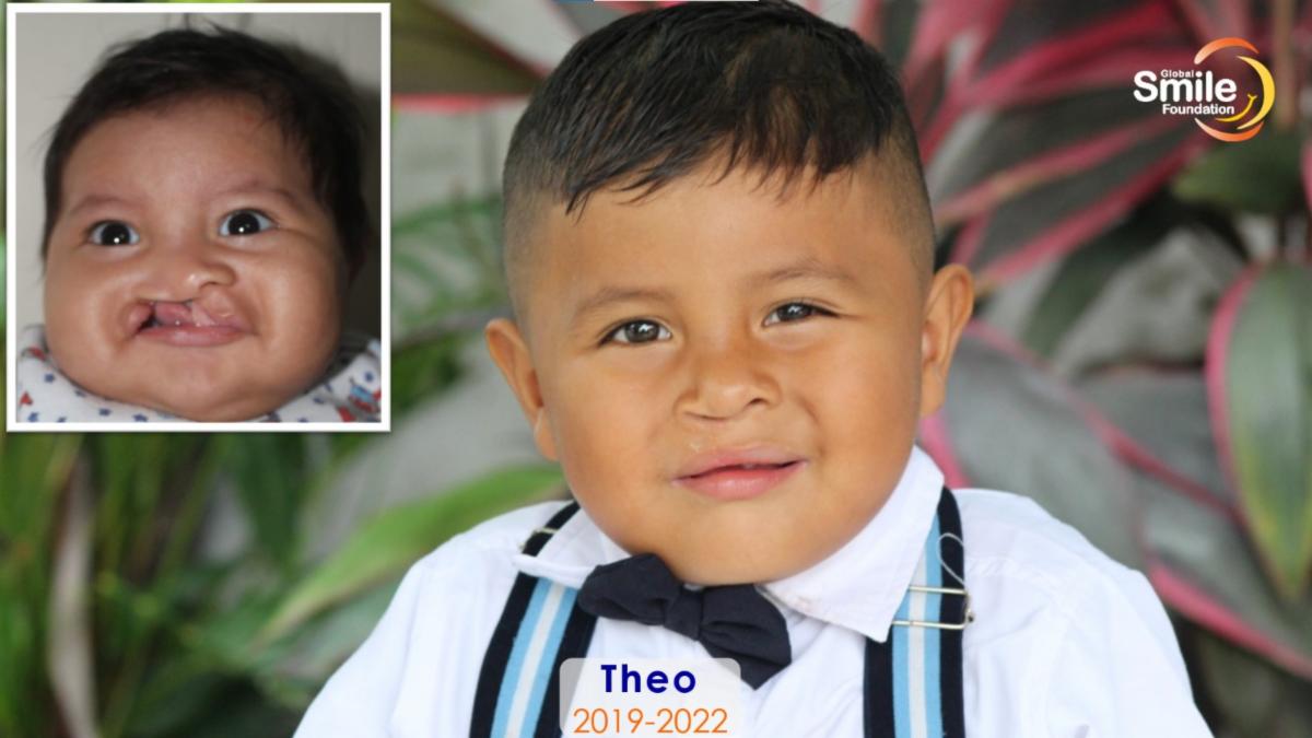 This week's milestone in Ecuador, Theo's Healthy Smile