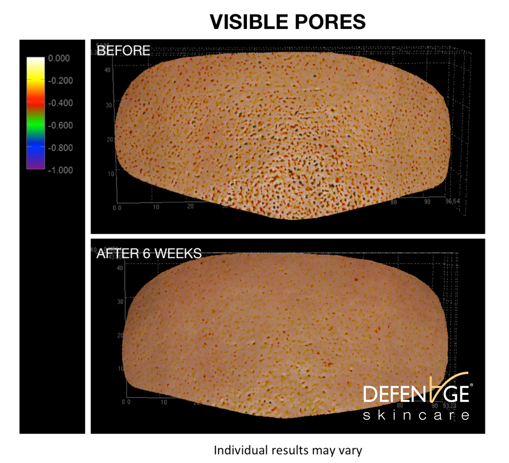 DefenAge® Skincare Announces PRO EXCLUSIVE Line, Only Available in ...