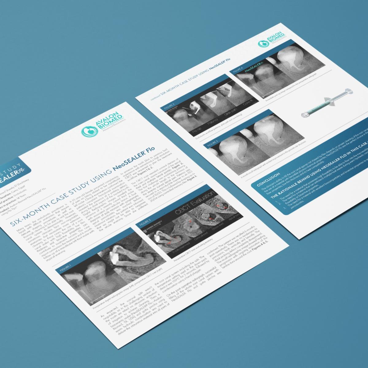 Tijd voor de volgende generatie biokeramische wortelkanaal sealers!