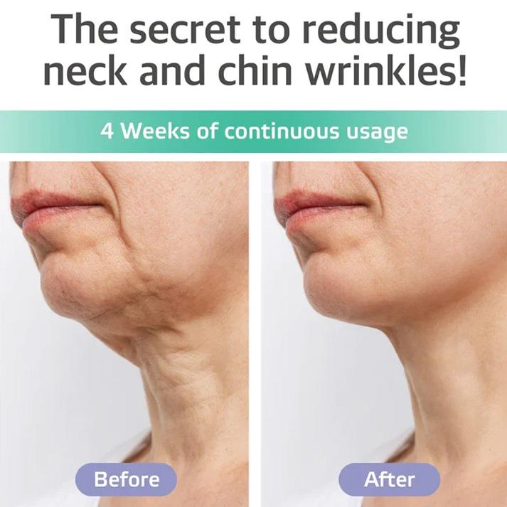 Reduce Double Chin with 10 Non-Invasive Techniques!