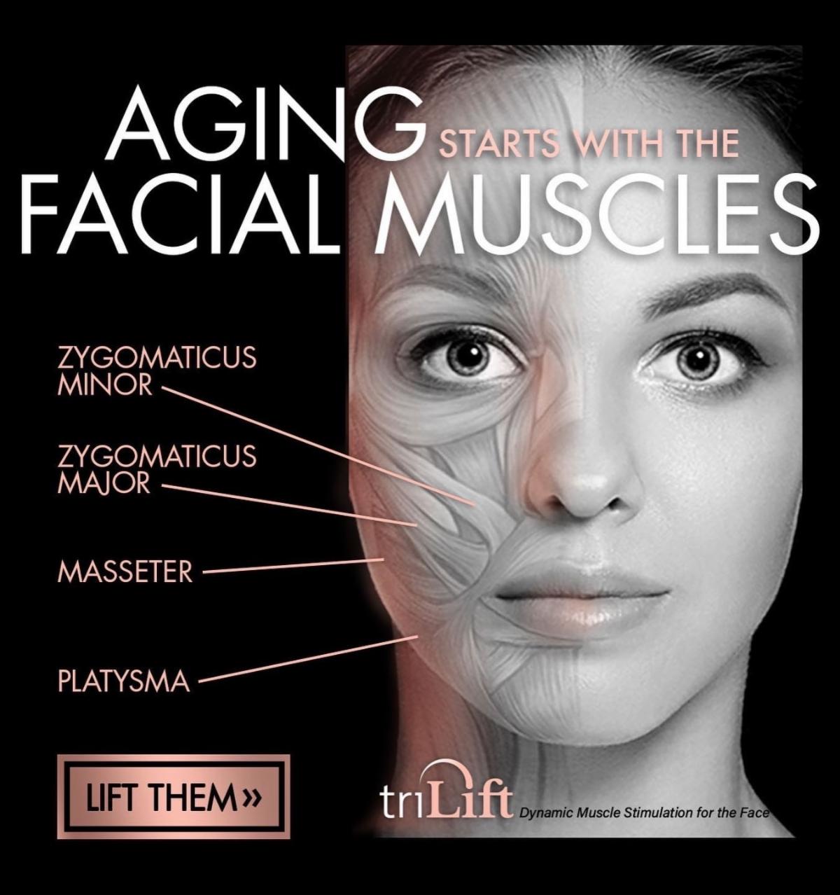 TriLift- The Non-surgical FaceLift
