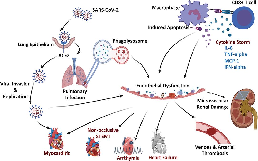 Clinical Examples Of Microvascular Endothelial Dysfunction Consequences