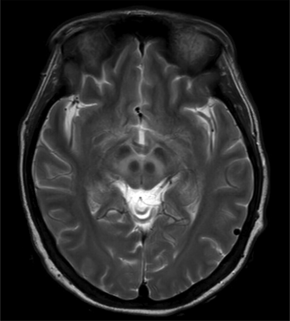 Neurology Newsletter