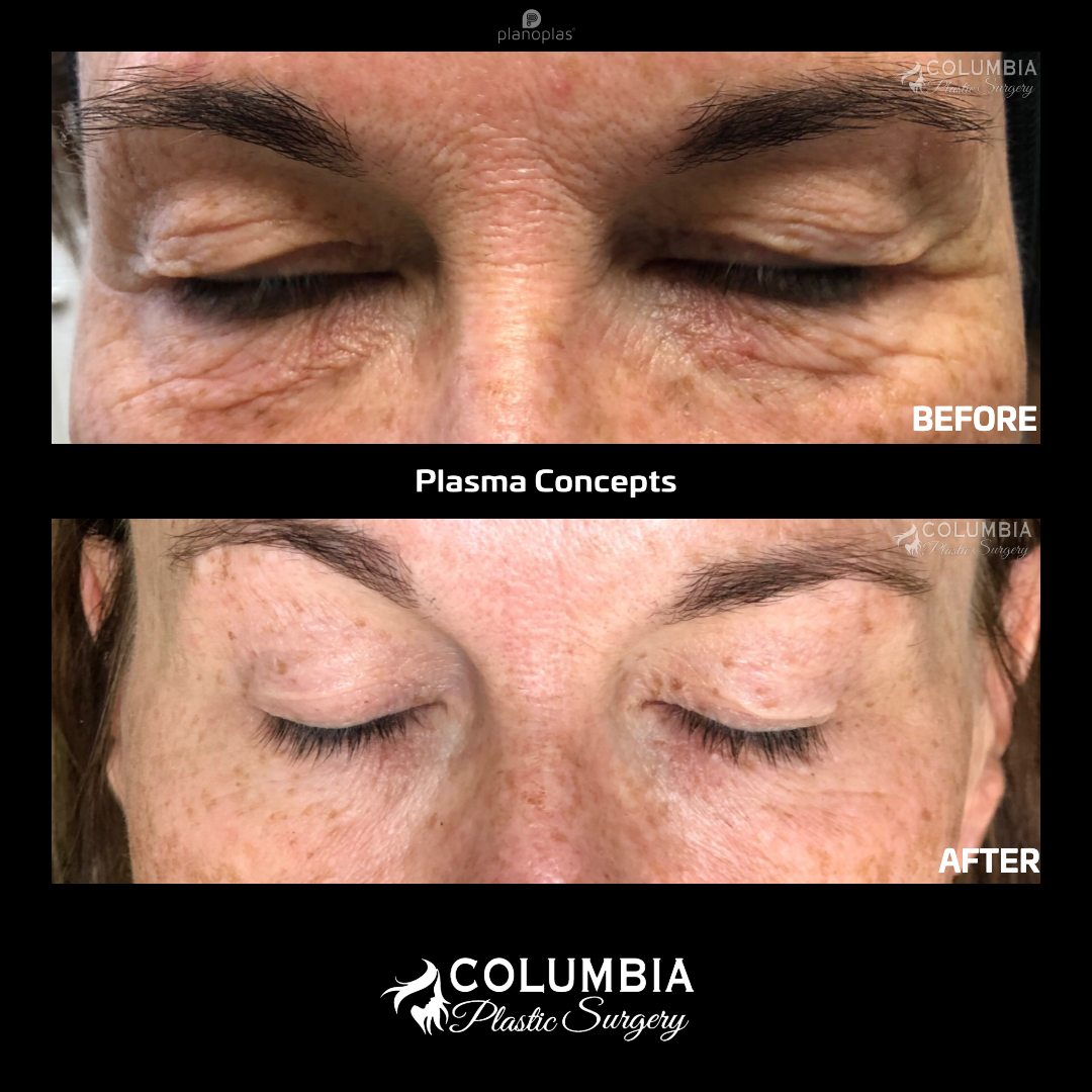 🖊MODELS NEEDED in Woburn MA