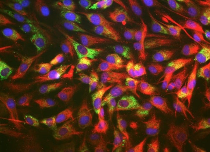 Versatile Nestin Antibodies