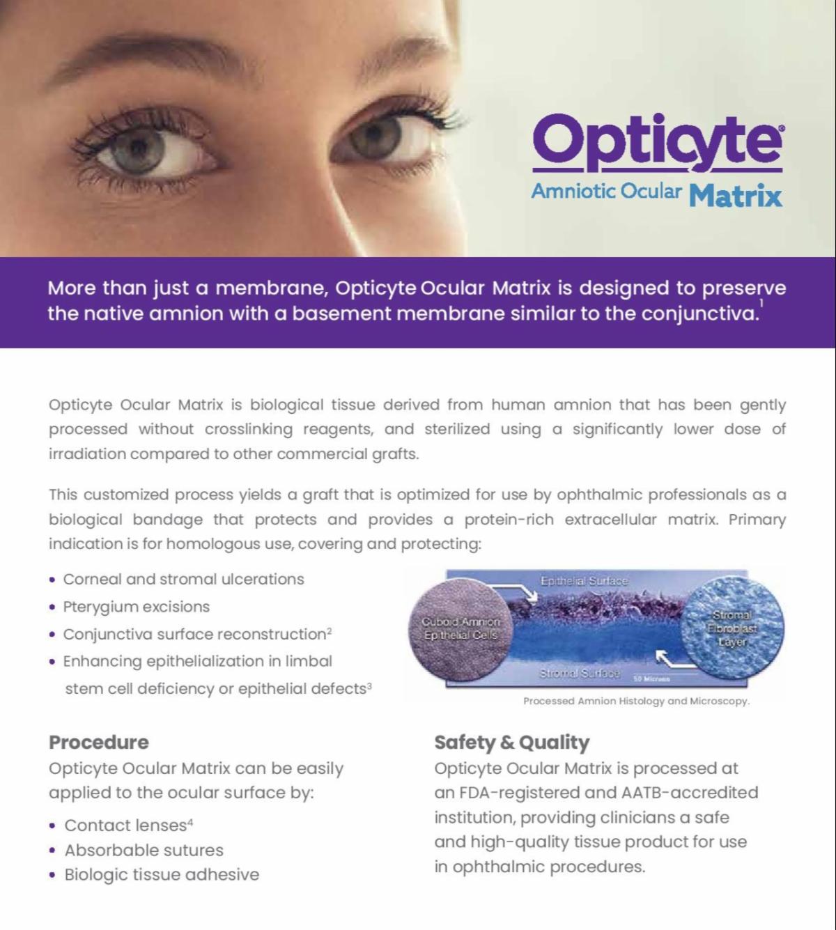 Opticyte Amniotic Ocular Matrix