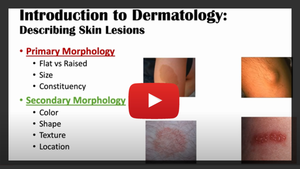 Dermatologic Description of Skin Lesions